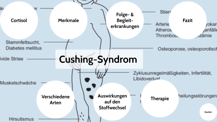 Cushing-Syndrom by Antonia Hüttemann on Prezi
