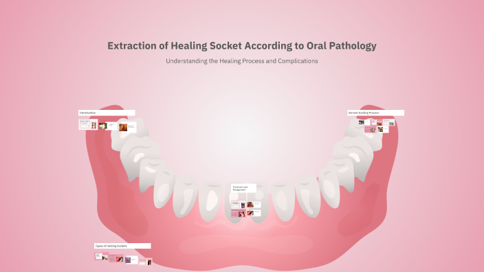 Extraction of Healing Socket According to Oral Pathology by Sam Brown ...