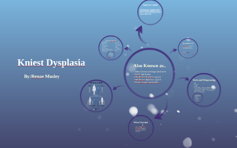 Kniest Dyplasia by Renae Mosley on Prezi