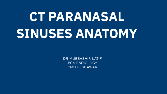 Ct Paranasal Sinuses Anatomy By Mubbashir Latif On Prezi