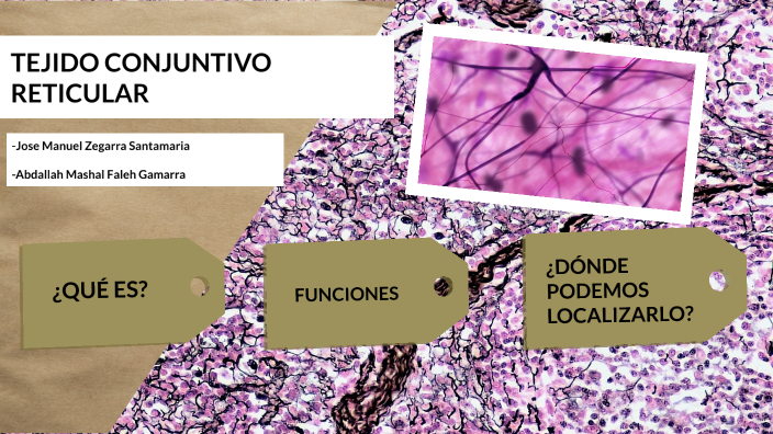 TEJIDO CONJUNTIVO RETICULAR by jose manuel