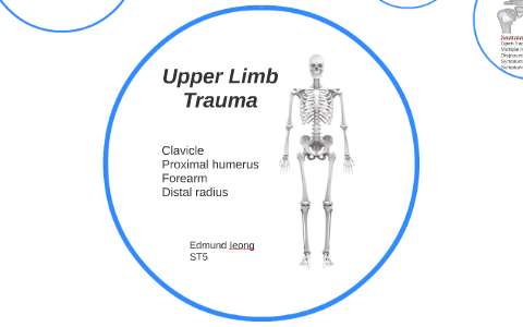 Upper Limb Trauma by Edmund Ieong on Prezi