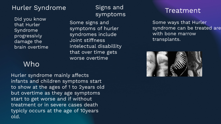 Hurler Syndrome by angel Sanchez on Prezi