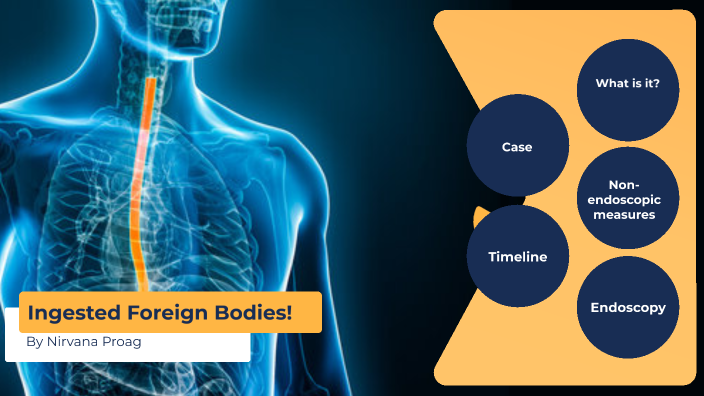 Ingested Foreign Bodies!! by gordon ramsay on Prezi