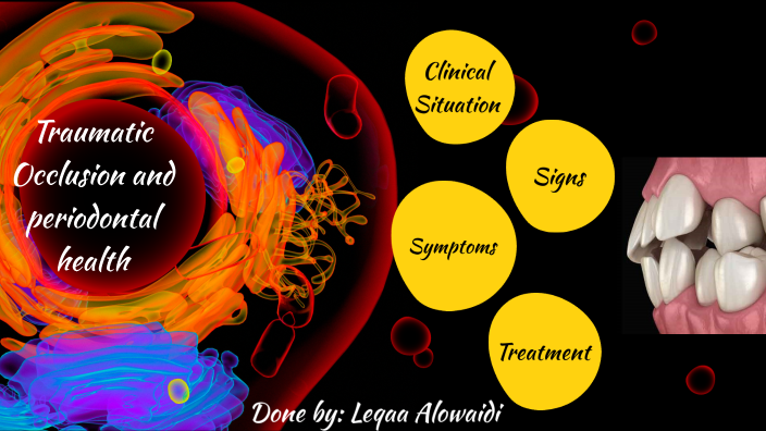 Traumatic occlusion and periodontal health by Leqaa Abdullah on Prezi
