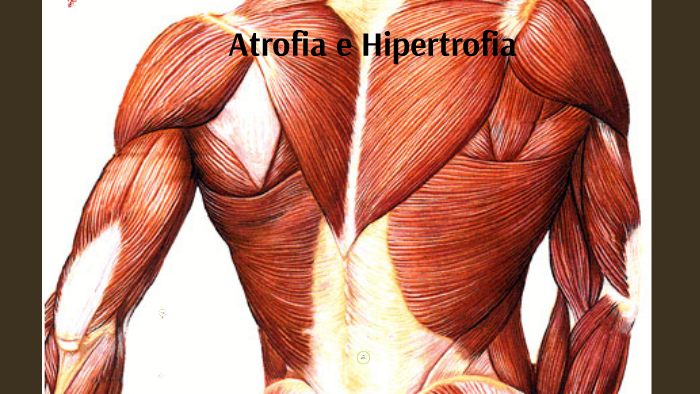 Atrofia e Hipertrofia by natalia fernandes on Prezi