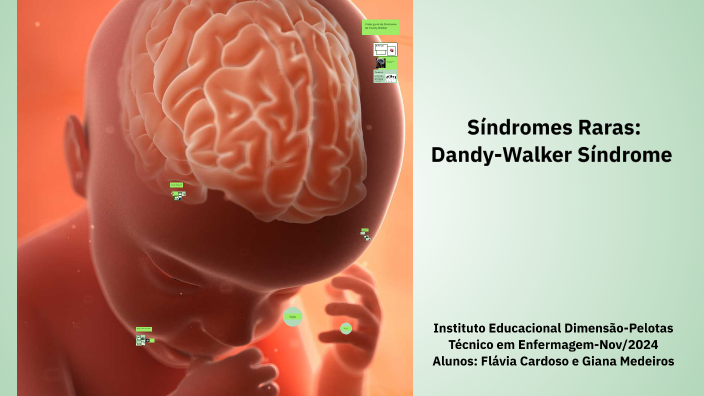 Rare Syndromes: Dandy-Walker Syndrome by flavia cardoso on Prezi