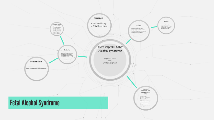 Birth defects: Fetal Alcohol Syndrome by Jessi James on Prezi
