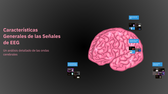 Características Generales de las Señales de EEG by Larissa Otero on Prezi