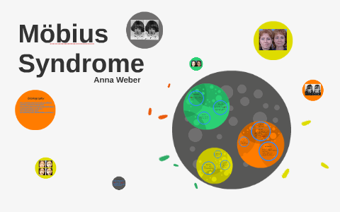 Mobius Syndrome by Anna Weber on Prezi