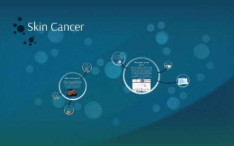 Skin Cancer by anthony lin on Prezi