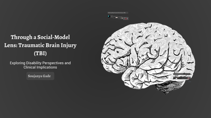 Through a Social-Model Lens: Traumatic Brain Injury (TBI) by Soujanya ...