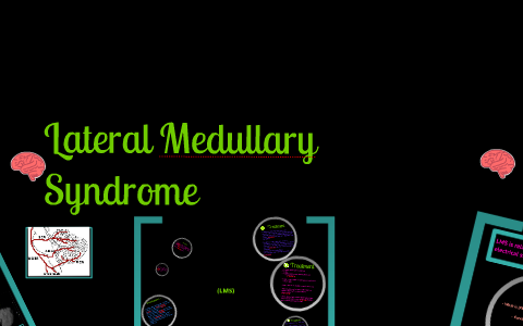 Lateral Medullary Syndrome by robert D. on Prezi
