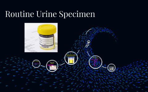 Routine Urine Specimen by courtney long on Prezi