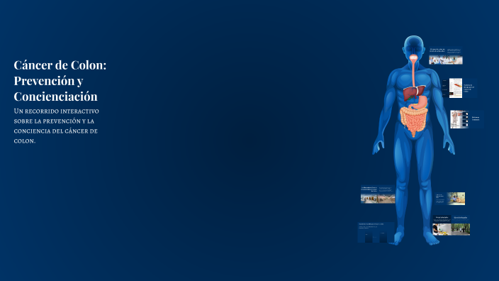 Cáncer de Colon: Prevención y Concienciación by Luis Obed Fernandez on ...