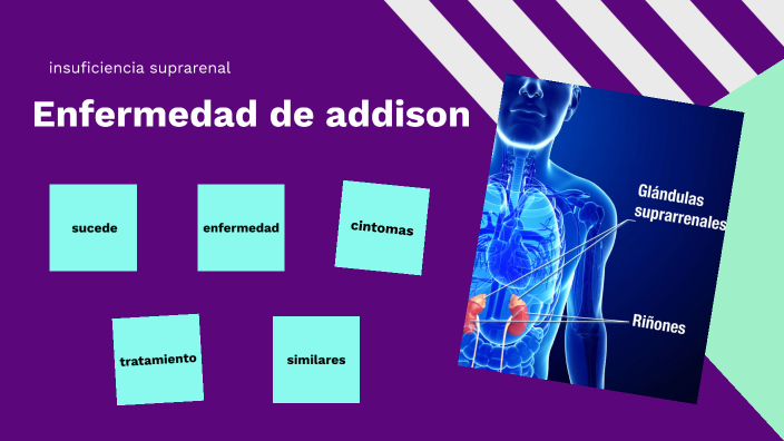 enfermedad de addison by sofia martinez on Prezi