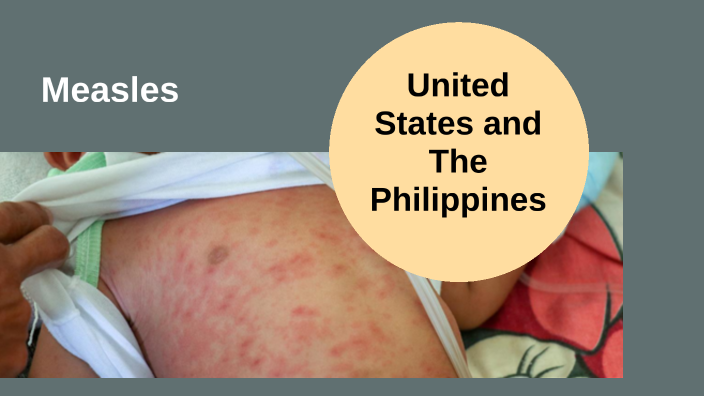 Measles: United States and The Philippines by Madison Meadors on Prezi