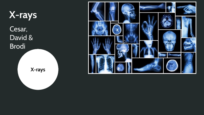 X-rays by Cesar Garcia on Prezi