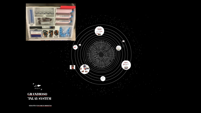 GRANDIOSO "INLAY SYSTEM by sebastian escorcia on Prezi