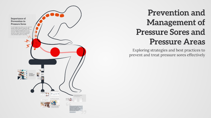 Prevention and Management of Pressure Sores and Pressure Areas by ...