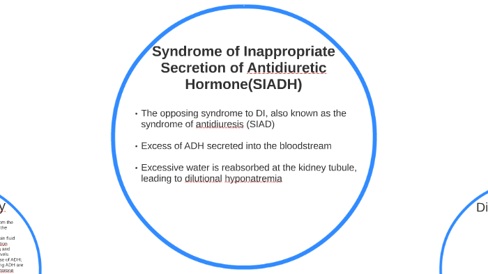 SIADH by Derek Magno on Prezi