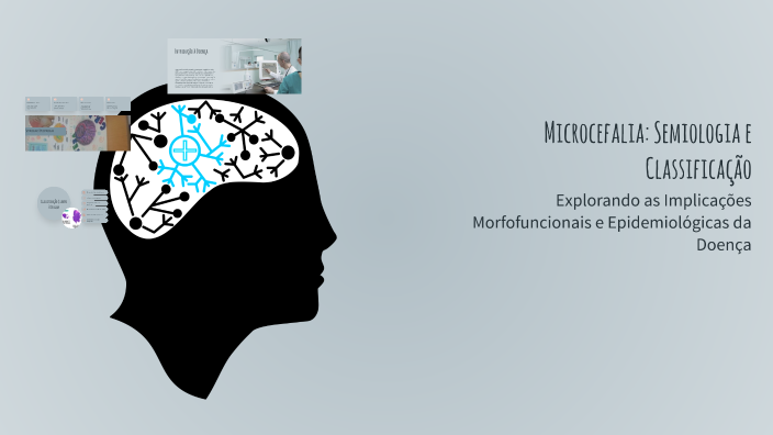 Microcefalia: Semiologia e Classificação by Carlos Feitosa on Prezi
