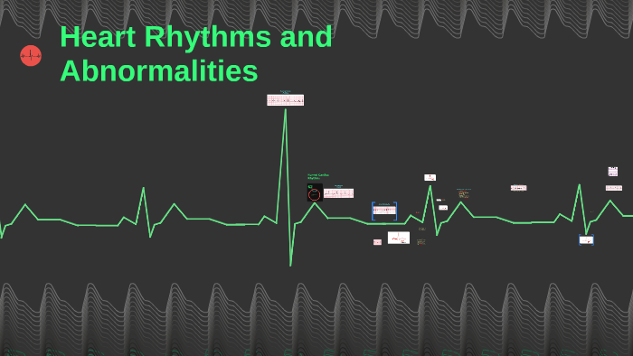 Abnormal Heart Rhythms and Cardiac Arrest by alexandria hall on Prezi