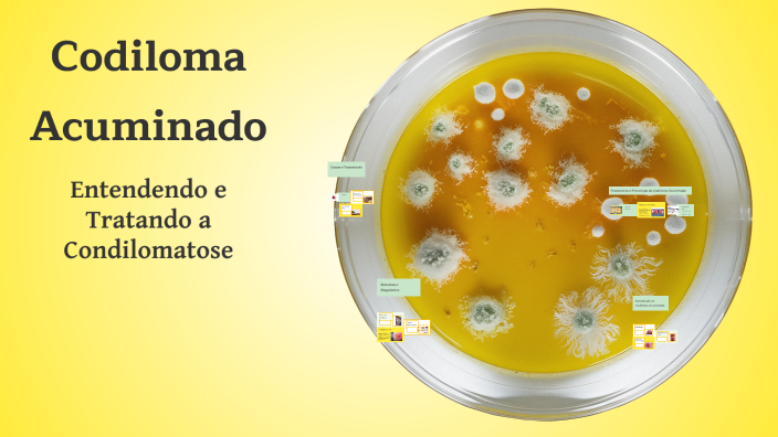 Codiloma Acuminado by Marilda Maria Dias on Prezi
