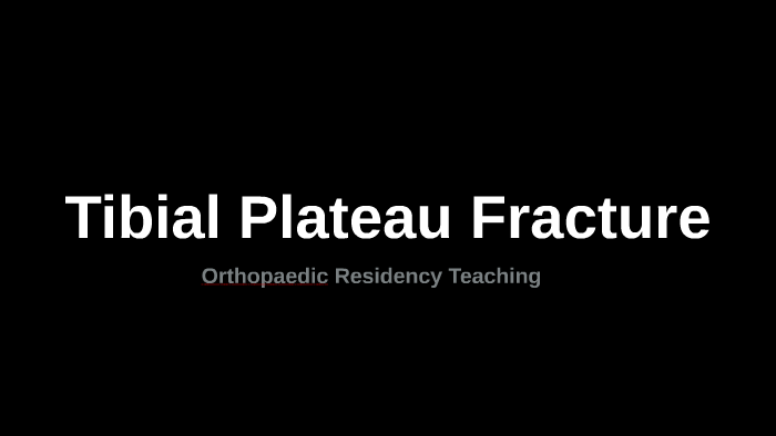 Tibial Plateau Fractures by Emir Battaloglu on Prezi