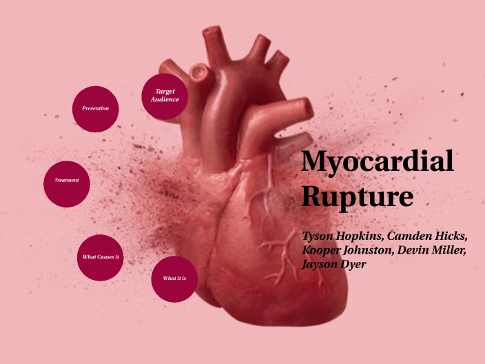 Heart Rupture by Kooper Johnston on Prezi