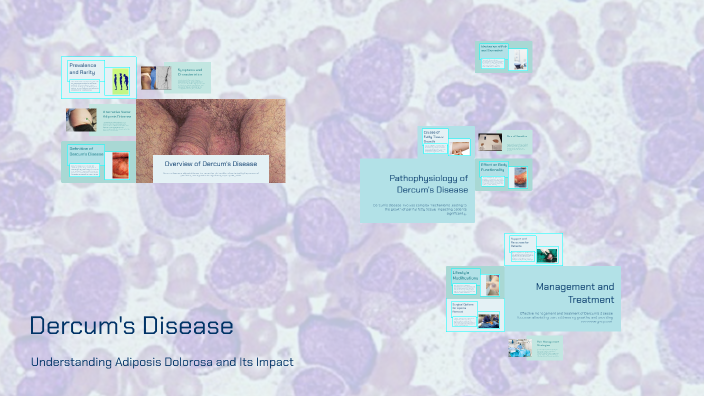 Dercum's Disease by Ben Bandeira _ Student - Wakefield on Prezi