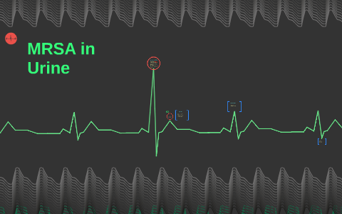 MRSA in Urine by Justin Denman on Prezi