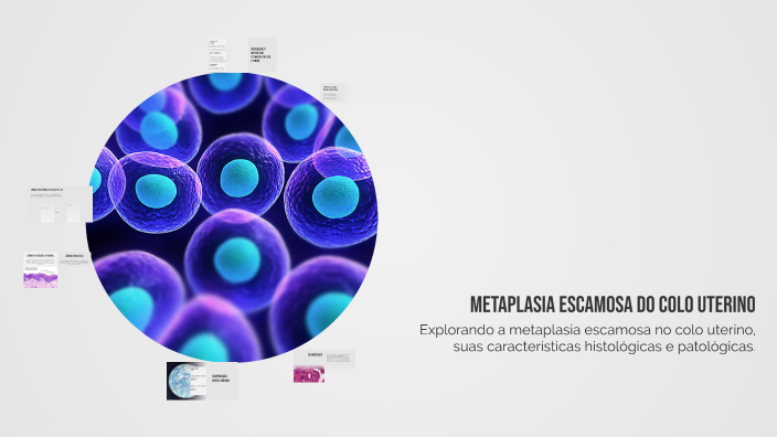 Metaplasia Escamosa do Colo Uterino by Beatriz Almeida on Prezi