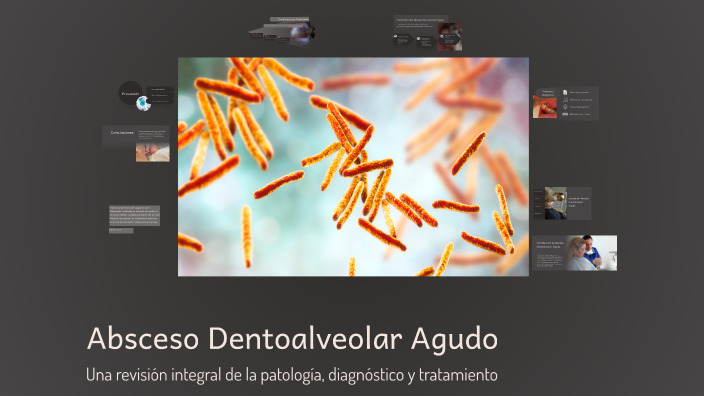 Absceso Dentoalveolar Agudo by Leila Almaguer on Prezi