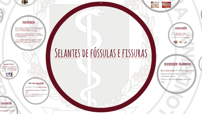 Selantes de fossulas e fissuras by Cristiane Hara on Prezi
