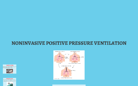 NONINVASIVE POSITIVE PRESSURE VENTILATION by Sidra Muntaha on Prezi