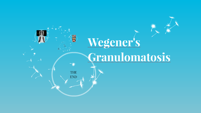 Wegener's Granulomatosis by Madison Willman on Prezi