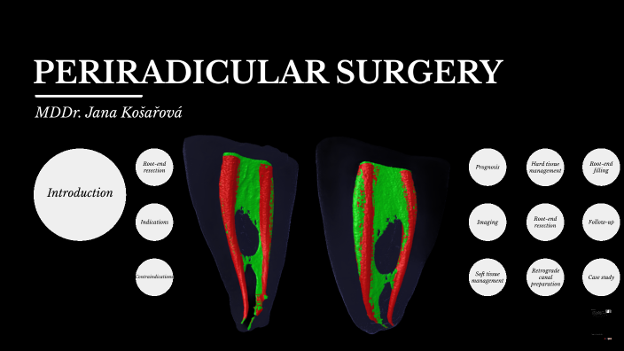 Periradicular Surgery by Jana Krocová on Prezi