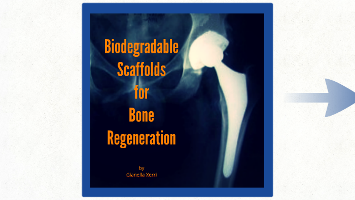 Biodegradable Bone Scaffolds for Bone Regeneration by gianella xerri