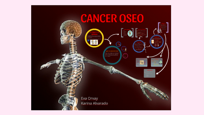CANCER OSEO by Eva Orvay on Prezi