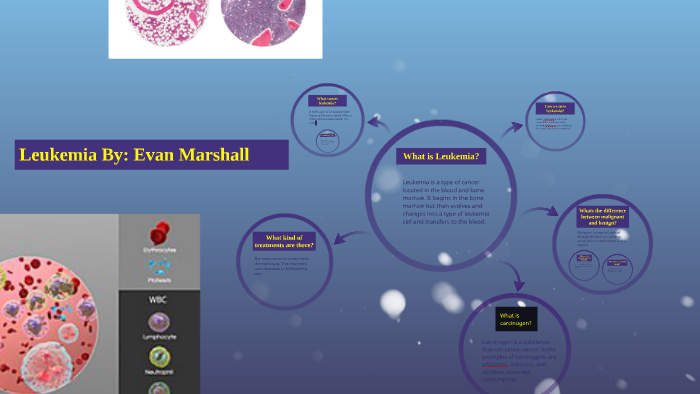 Leukemia Project by Evan Marshall on Prezi