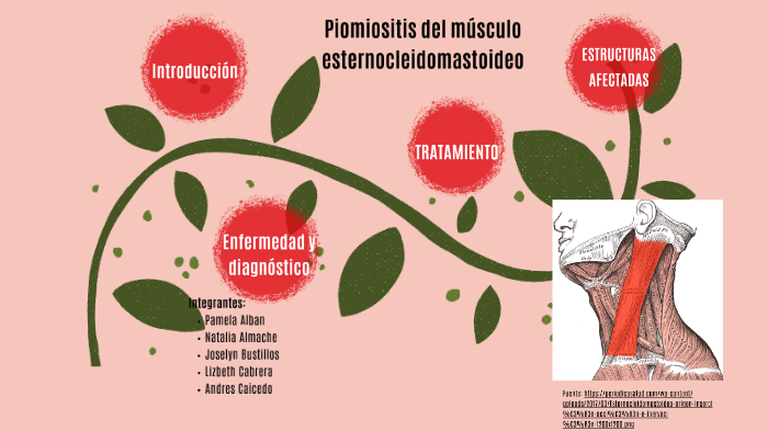 Caso clinico: PIOMIOSITIS DEL MÚSCULO ESTERNOCELIDOMASTOIDEO by Natalia ...