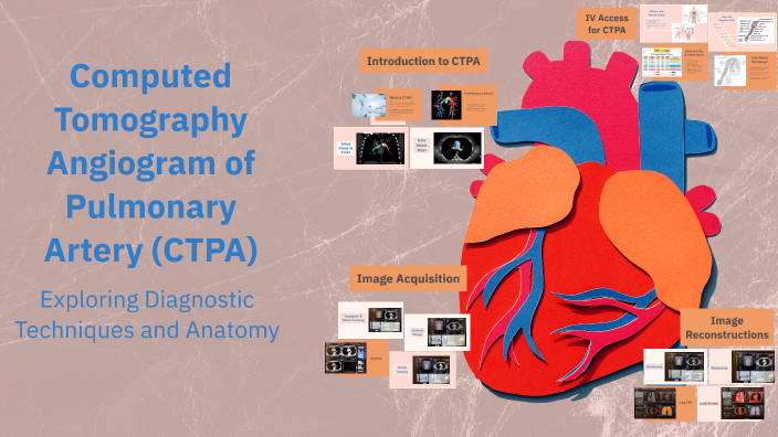 Computed Tomography Angiography of Pulmonary Artery (CTPA) by Faiz Naim ...
