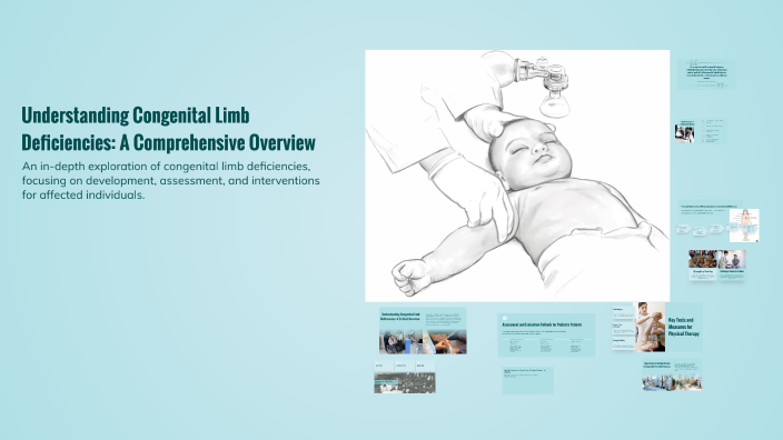 Understanding Congenital Limb Deficiencies: A Comprehensive Overview by ...