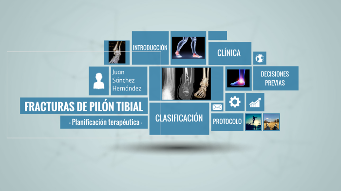 Fx de pilón tibial - 1 by Juan Sánchez on Prezi
