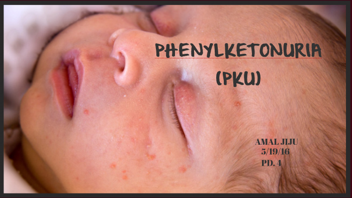 PHENYLKETUNRIA (PKU) by Amal Jiju on Prezi