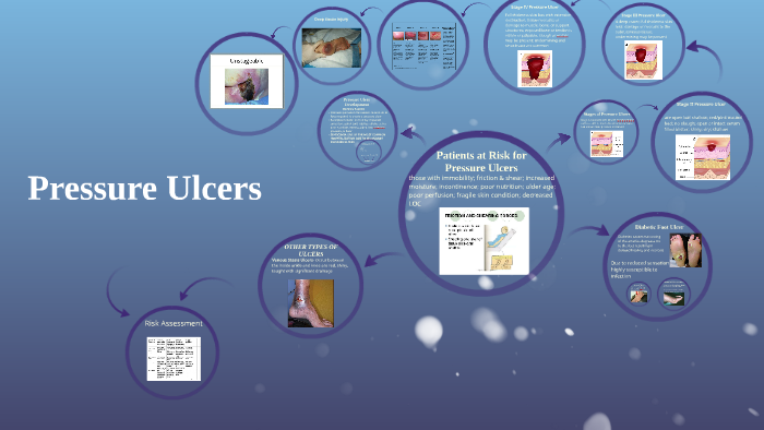 Pressure Ulcers by Natalie Salgado on Prezi