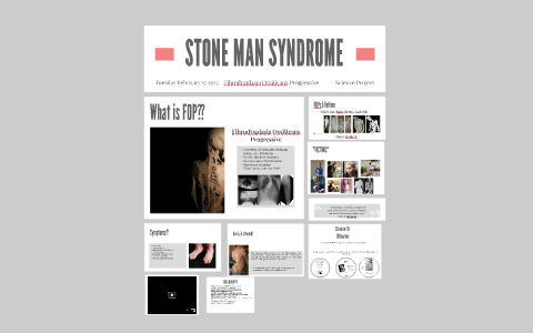 Stone Man Syndrome by Valen Uribe on Prezi
