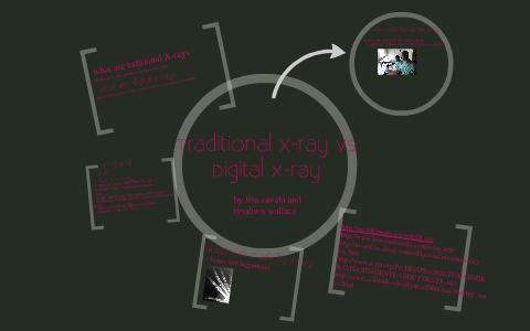 Traditional X-ray vs Digital X-ray by Walter Wallace on Prezi