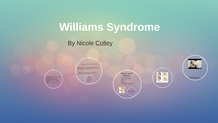 Williams Syndrome by nicole colley